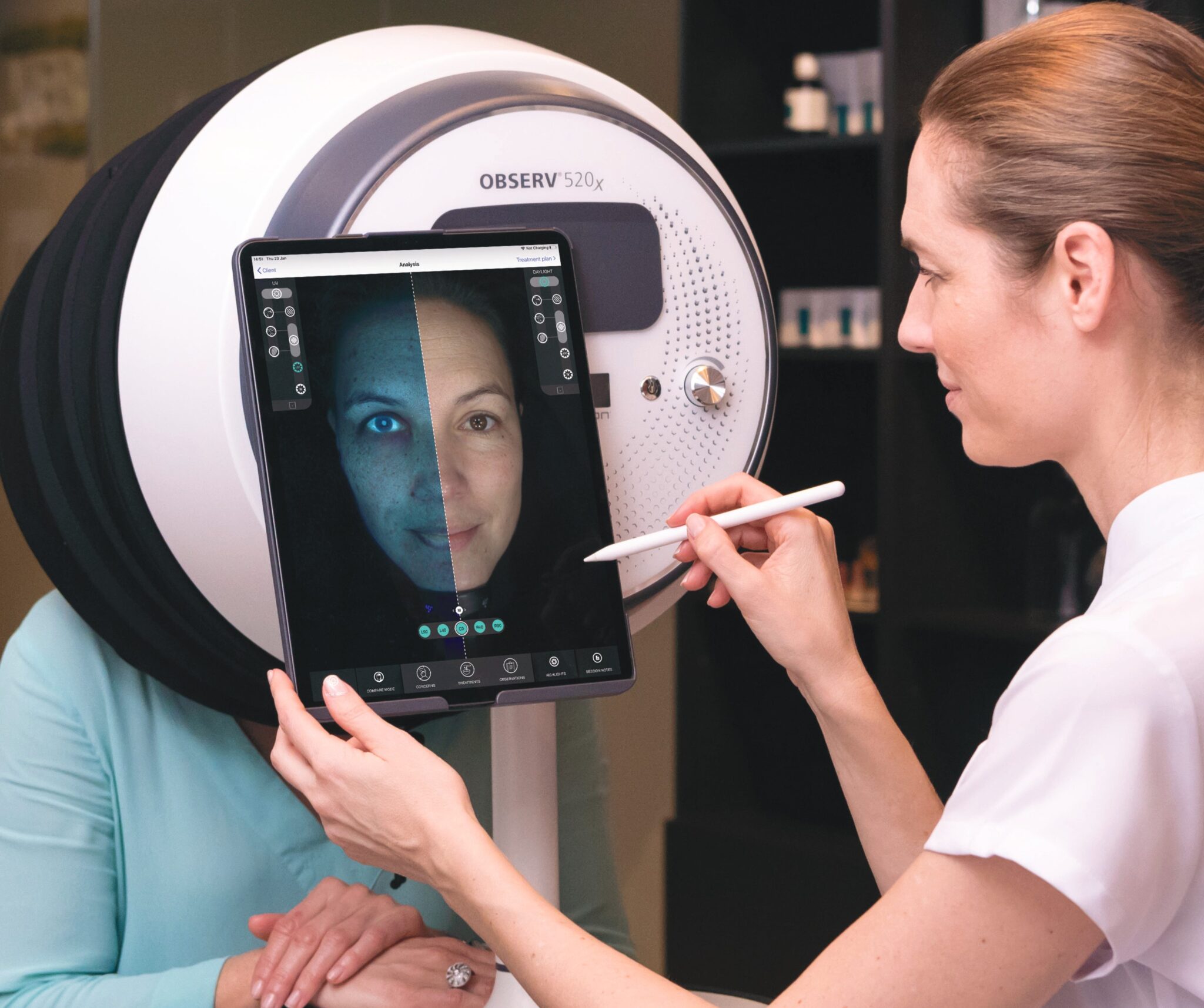 Observe 520 Camera Skin Analysis | Newcastle | Westfield Kotara